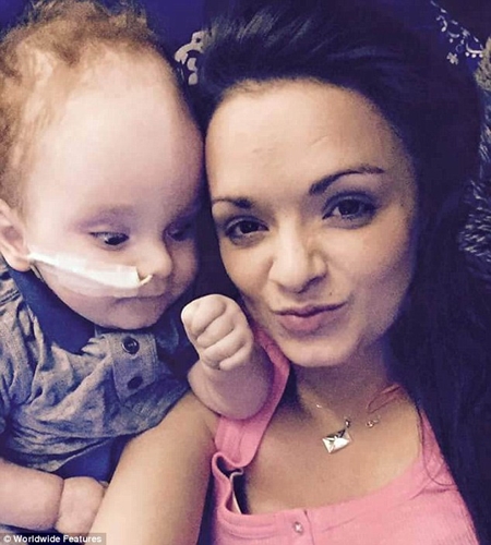 Baby Born Without a Brain Amazes Doctors by Celebrating his 2nd ...