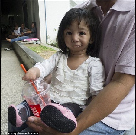 Born Without A Mouth