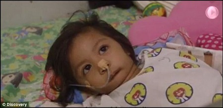 Girl Born With No Lips Or Jaw | Lipstutorial.org