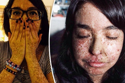 See Woman Who Lived All Her Life Indoors and Could Die if She Steps ...