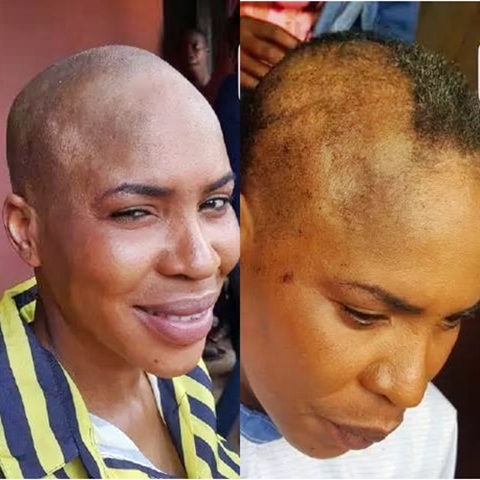 Omg! See What Has Happend to Popular Nollywood Actress' Head (Photos)