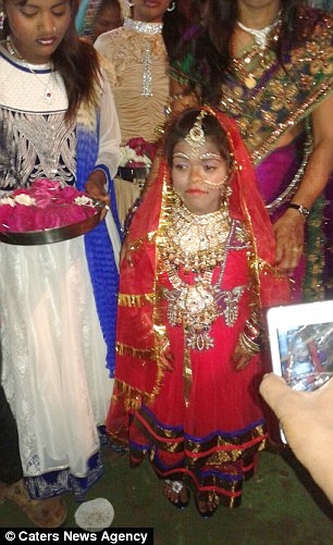 Indian Dwarfs Becomes One of the World's Smallest Couples as they Ties ...