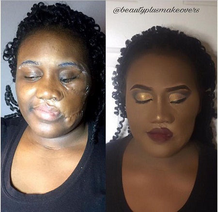 Shocking! The Facial Transformation of this Woman Will Leave You in ...