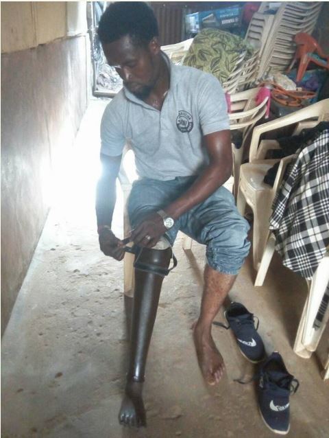 Coca-Cola abandons staff who was amputated after Injury (Photos) - Kemi ...