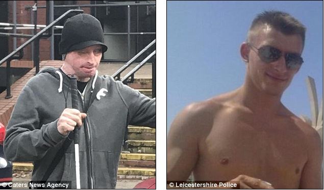 'Crazy Girlfriend' Jailed for Life After She Poured Acid on Her ...