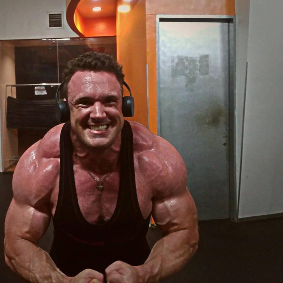 Young Bodybuilder's Body Begins Rotting After Taking Steroids To ...