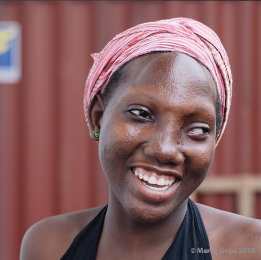 Young Girl With Deformed Face Gets New Life After Undergoing Surgery To