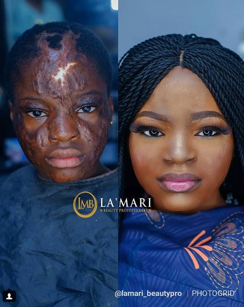 Shocking Makeup Transformation Of Young Lady Whose Face Was Disfigured ...