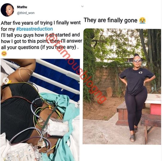 Read The Shocking Story Of Lady Struggling To Live With Her Heavy ...