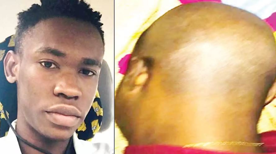 Nigerian University Student Reveals How FSARS Operatives Shaved His ...