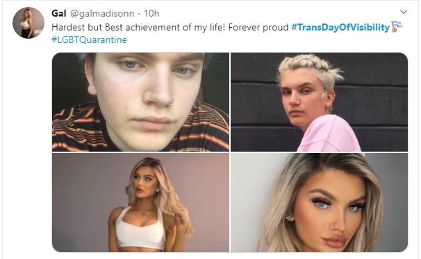 WOW!! Before And After Photos Of Trans Men And Women That Would Leave ...