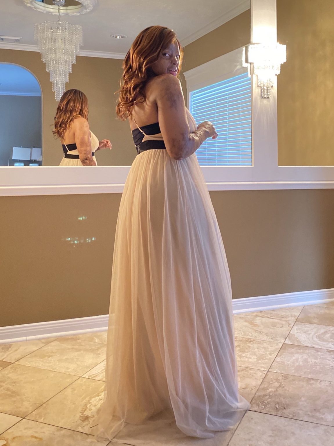 Crash Survivor And Singer, Kechi Okwuchi Shares Stunning Photos to ...