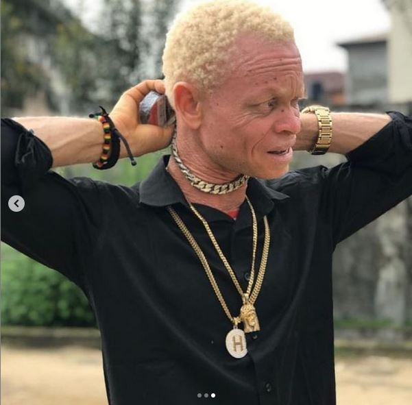 Women Often Reject Me Because I Am Albino – Expatriate Comedian Reveals