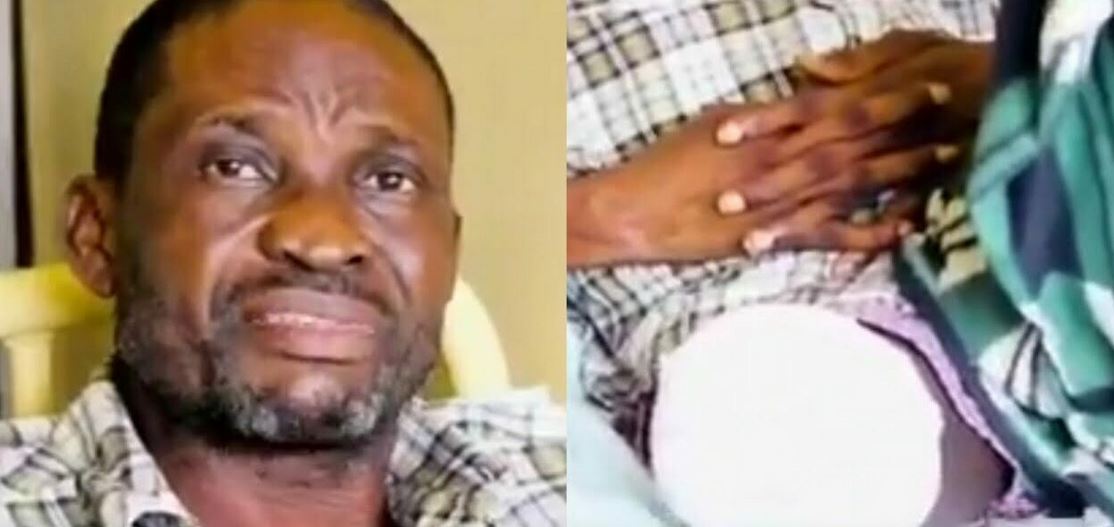 Filmmaker Ademola Adelakun Begs For Support After Losing Leg To Diabetes