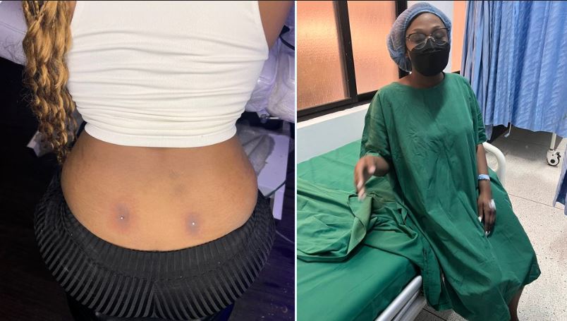 Back Dimple Piercing