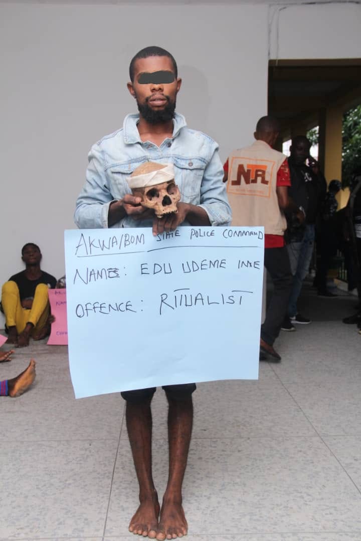 Suspected Ritualist Arrested With Human Skull In Akwa Ibom (Photos)
