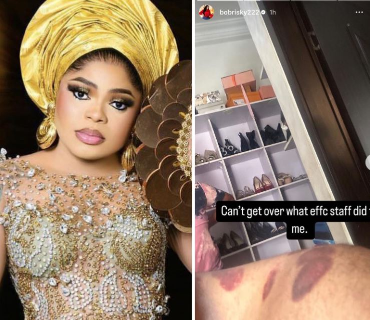 Bobrisky Shares Graphic Photos Of Injuries He Sustained From His ...