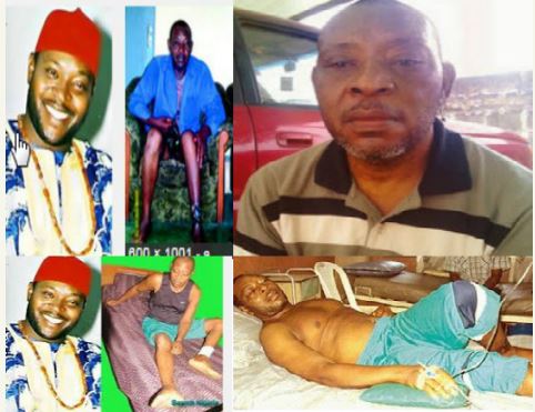 Sick Nollywood Actor, Prince James Uche Returns to the Hospital after ...