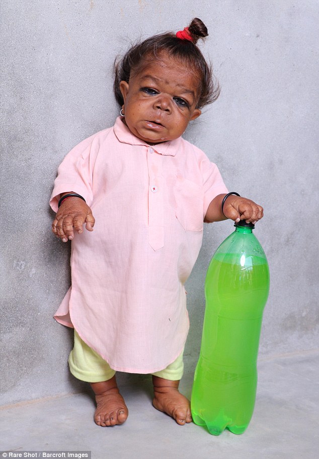 Unbelievable! See the 21-year-old Man Who Looks Like a Baby Because of ...