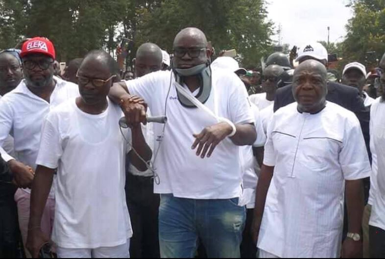 Nigerian Doctor Reveals New Twist About Fayose's 'Injuries'