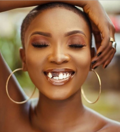 Nigerian Model Who Was Bullied Reveals How She Overcame Her ...