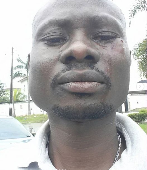 In Pictures: How I Was Brutally Battered By Davido's Boys - Mas Shares ...