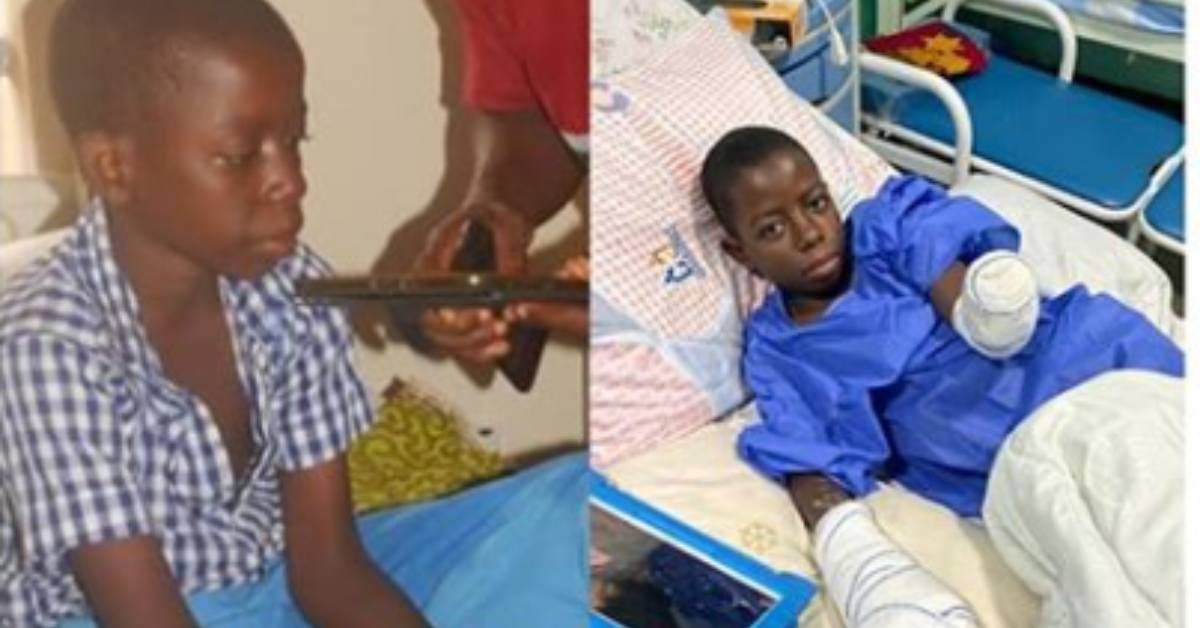 13-year-old Boy Loses His Hands After His Stepmother Burnt Them (Photo)