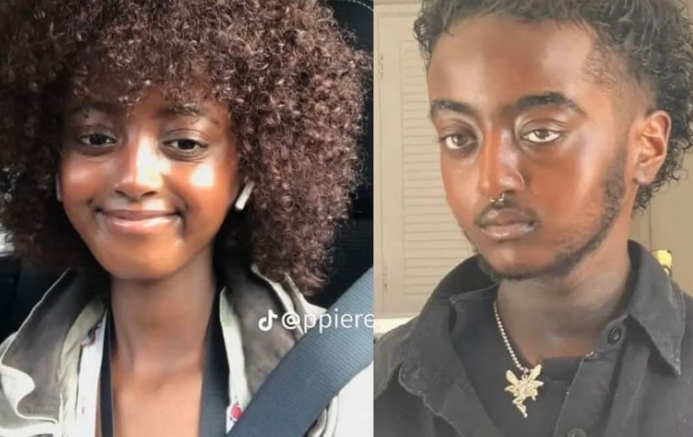 Lady Shares Photos Of Transformation After Undergoing Surgery To Fully ...