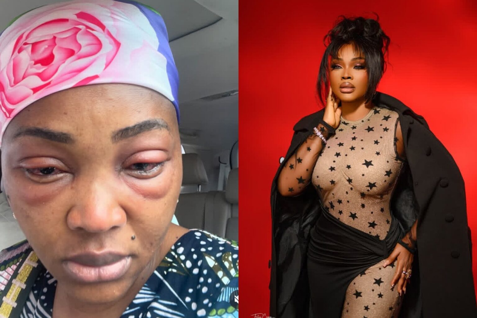 I Was Hospitalized – Mercy Aigbe Reveals Excruciating Pain She Suffered ...